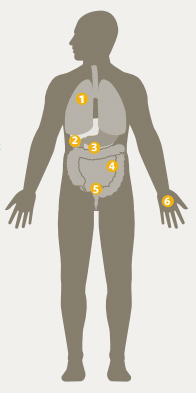 CF effects on the body